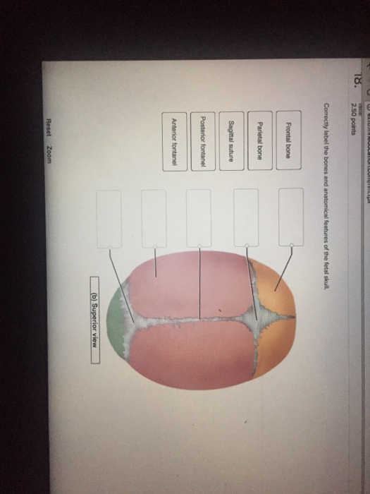 Solved Correctly Label The Bones And Anatomical Features Chegg