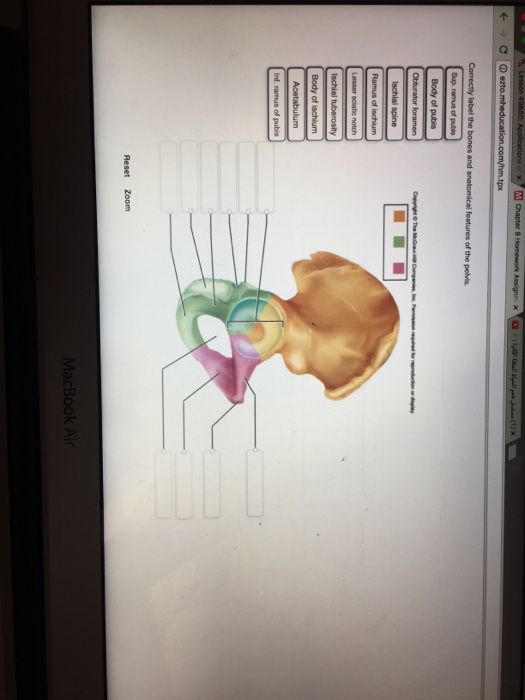 solved-correctly-label-the-bones-and-anatomical-features-chegg