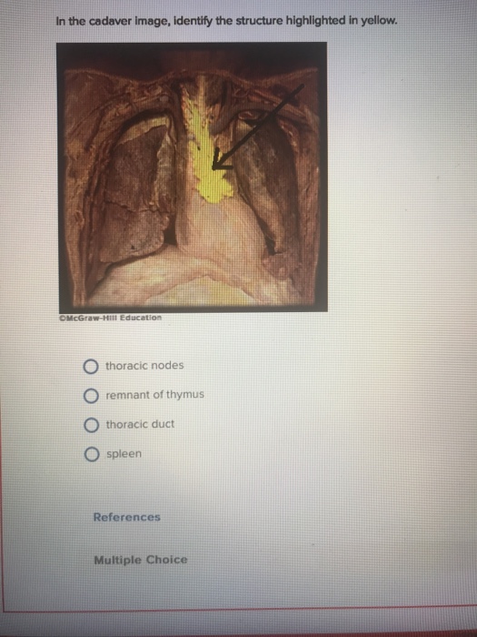 Solved: In The Cadaver Image, Identify The Structure Highl... | Chegg.com