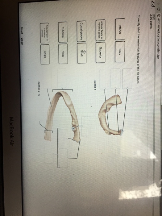 Solved Correctly Label The Anatomical Features Of The Rib