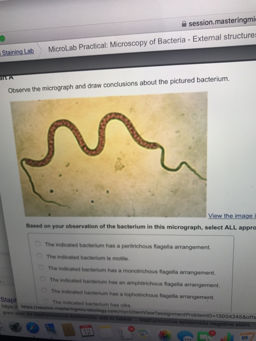 Solved: Observe The Micrograph And Draw Conclusions About ... | Chegg.com