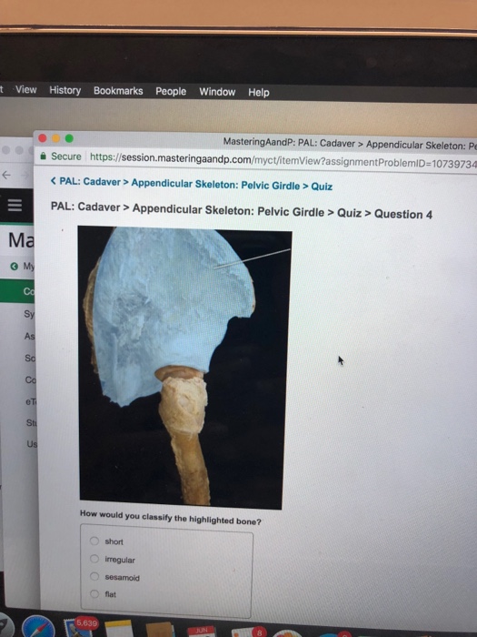 Solved: AL! Cadaver> Appendicular Skeleton: Pelvic Girdle ... | Chegg.com