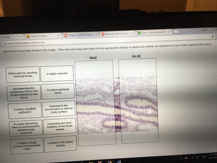 Solved: Identify The Tissue Type Shown In The Image. Then ... | Chegg.com