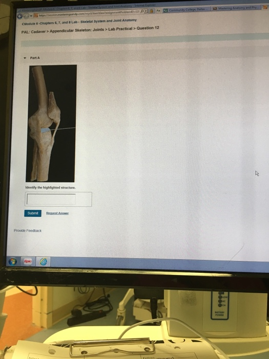 Solved: CModule Chapters 6,7, And Lab- Skeletal System And... | Chegg.com