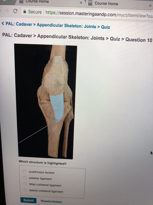 L: Cadaver> Appendicular Skeleton: Joints> Quiz > | Chegg.com
