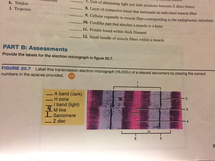 Solved: Provide The Labels For The Electron Micrograph In ... | Chegg.com