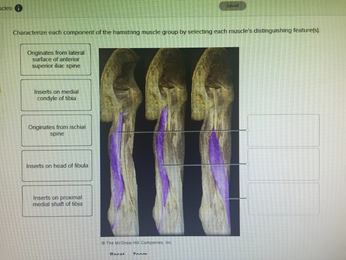 Solved: Cles Characterize Each Component Of The Hamstring ... | Chegg.com