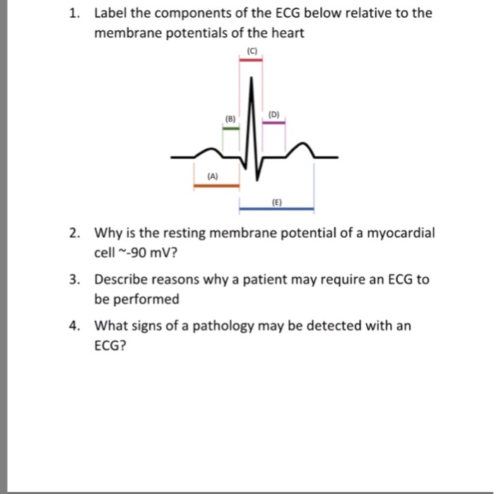 Solved Label the components of the ECG below relative to the | Chegg.com