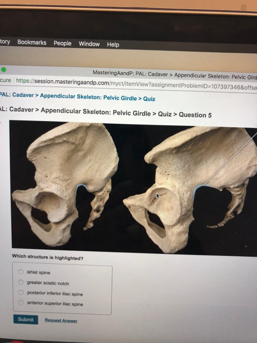 Solved: AL! Cadaver> Appendicular Skeleton: Pelvic Girdle ... | Chegg.com