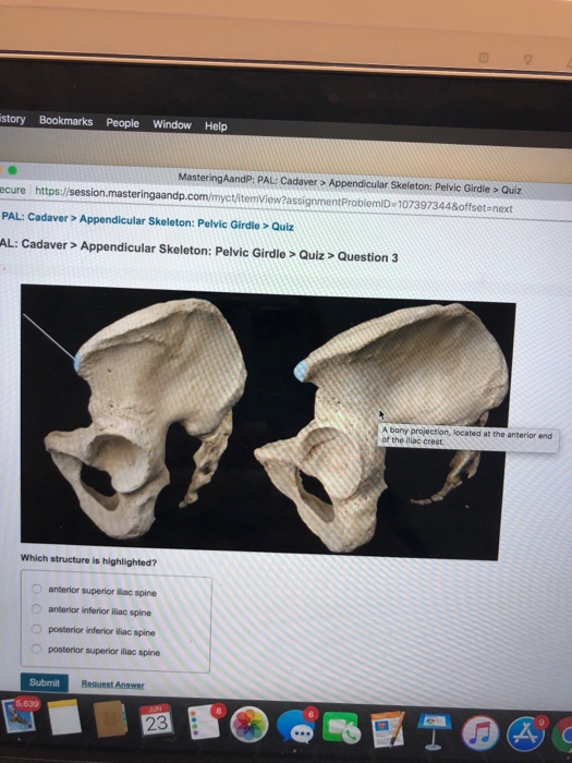 Solved: AL! Cadaver> Appendicular Skeleton: Pelvic Girdle ... | Chegg.com