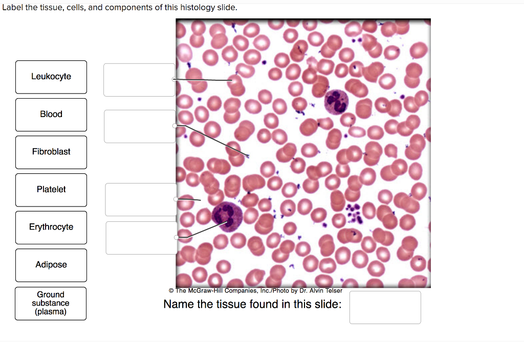 Solved: Correctly Identify This Tissue Type And Then Label... | Chegg.com