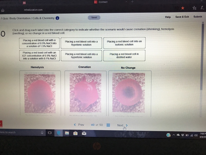 connect Quiz: Body Orientation /Cells& Chemistry Help | Chegg.com connect Quiz: Body Orientation /Cells& Chemistry Help | Chegg.com