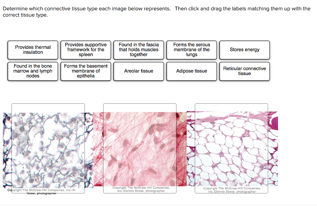Solved: Correctly Identify This Tissue Type And Then Label... | Chegg.com