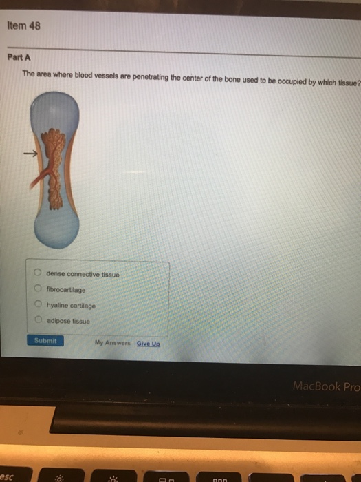 Solved The area where blood vessels are penetrating the | Chegg.com