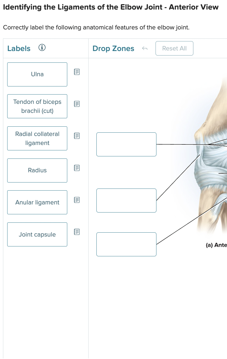 Solved Correctly label the following anatomical features of | Chegg.com