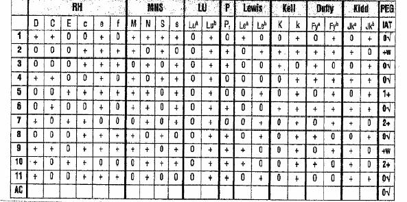 Solved BLOOD BANK HW HELP!! PLEASE :)) ANTIBODY PANEL 1.) | Chegg.com