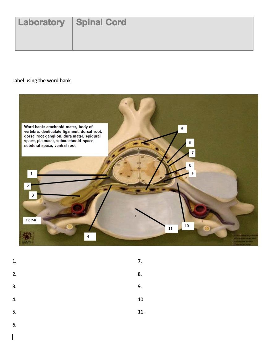Solved Laboratory Spinal Cord Label using the word bank 5 | Chegg.com