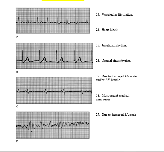 Solved 23. Ventricular fibrillation. 24. Heart block A 25. | Chegg.com
