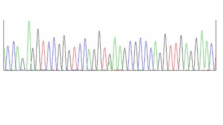 Solved Shown is an electropherogram of a segment of DNA from | Chegg.com