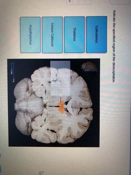 Solved Corpus Callosum 1 in | Chegg.com