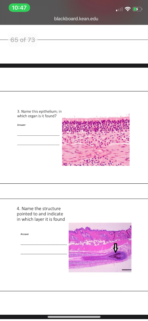 Solved 10:46 blackboard.kean.edu 1. Name the structure | Chegg.com