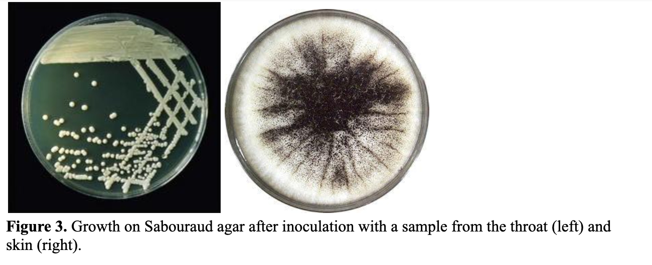 Solved Data Interpretation: After inoculating and incubating | Chegg.com