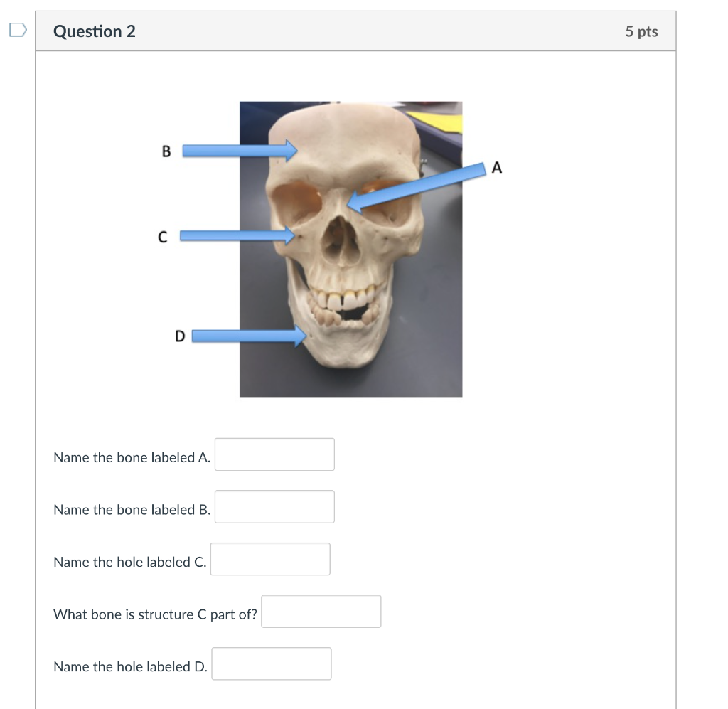 Solved Name the bone labeled A. Name the bone labeled B. | Chegg.com