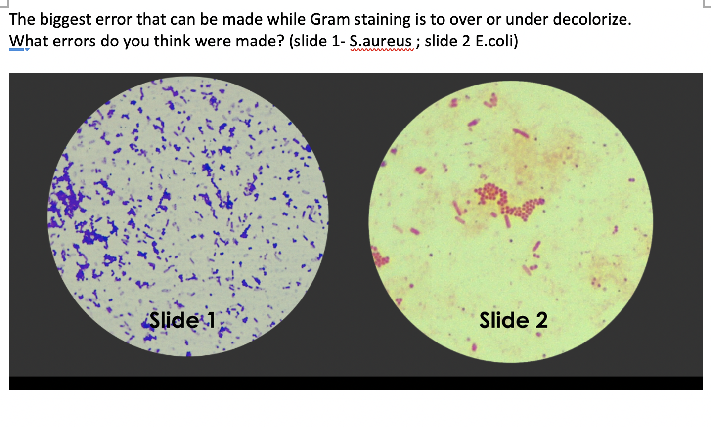 Solved The biggest error that can be made while Gram | Chegg.com