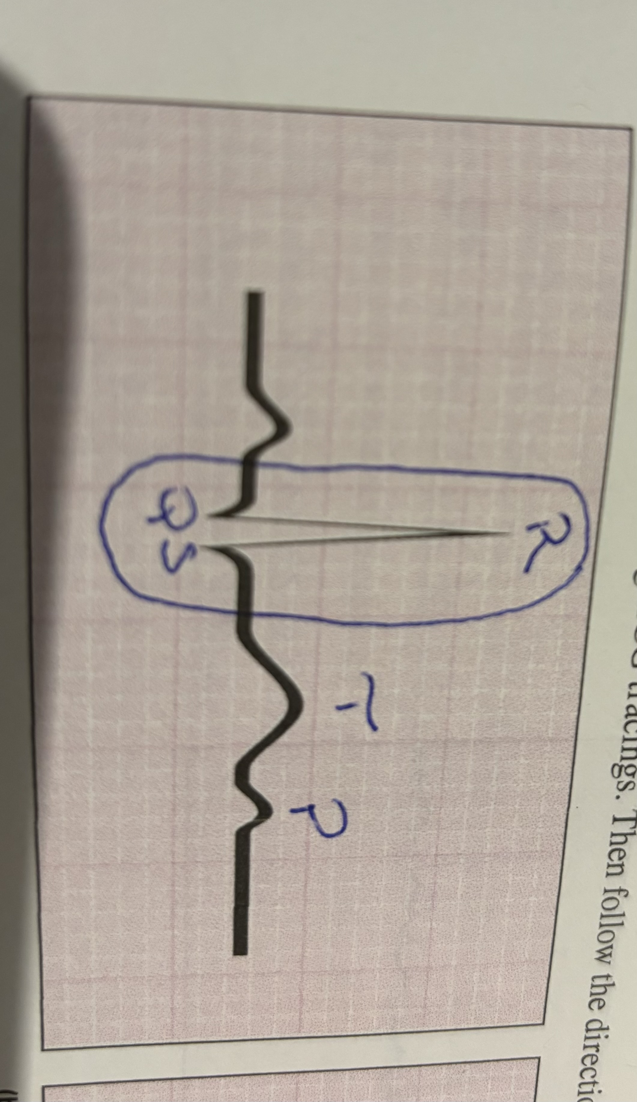 Solved Examine the following ECG tracings. Then follow the | Chegg.com