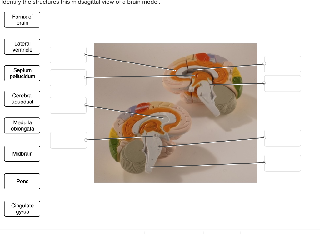 Solved Identify the structures on this anterior-lateral view | Chegg.com