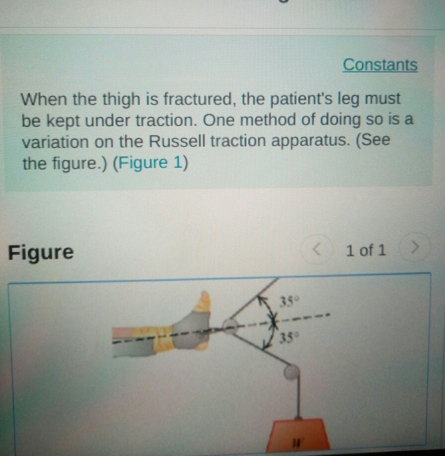 Solved Constants When the thigh is fractured, the patient's | Chegg.com