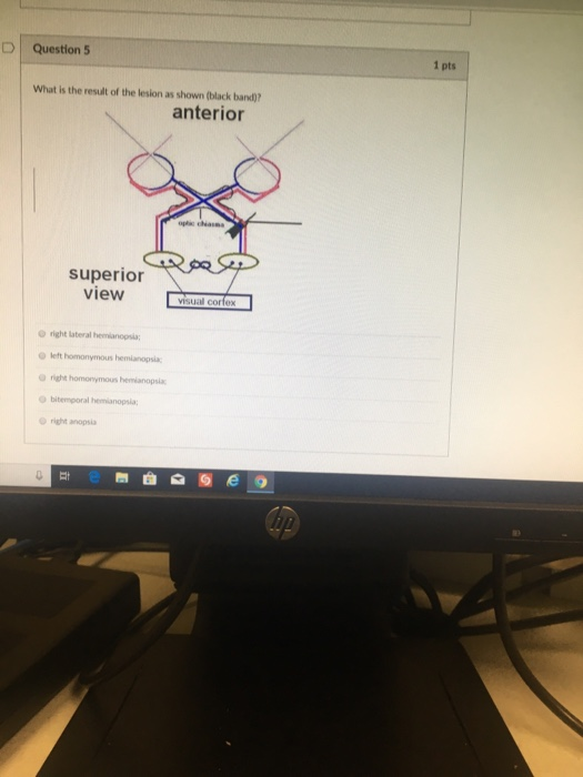Solved 1 pts Question 5 D | What is the result of the lesion | Chegg.com