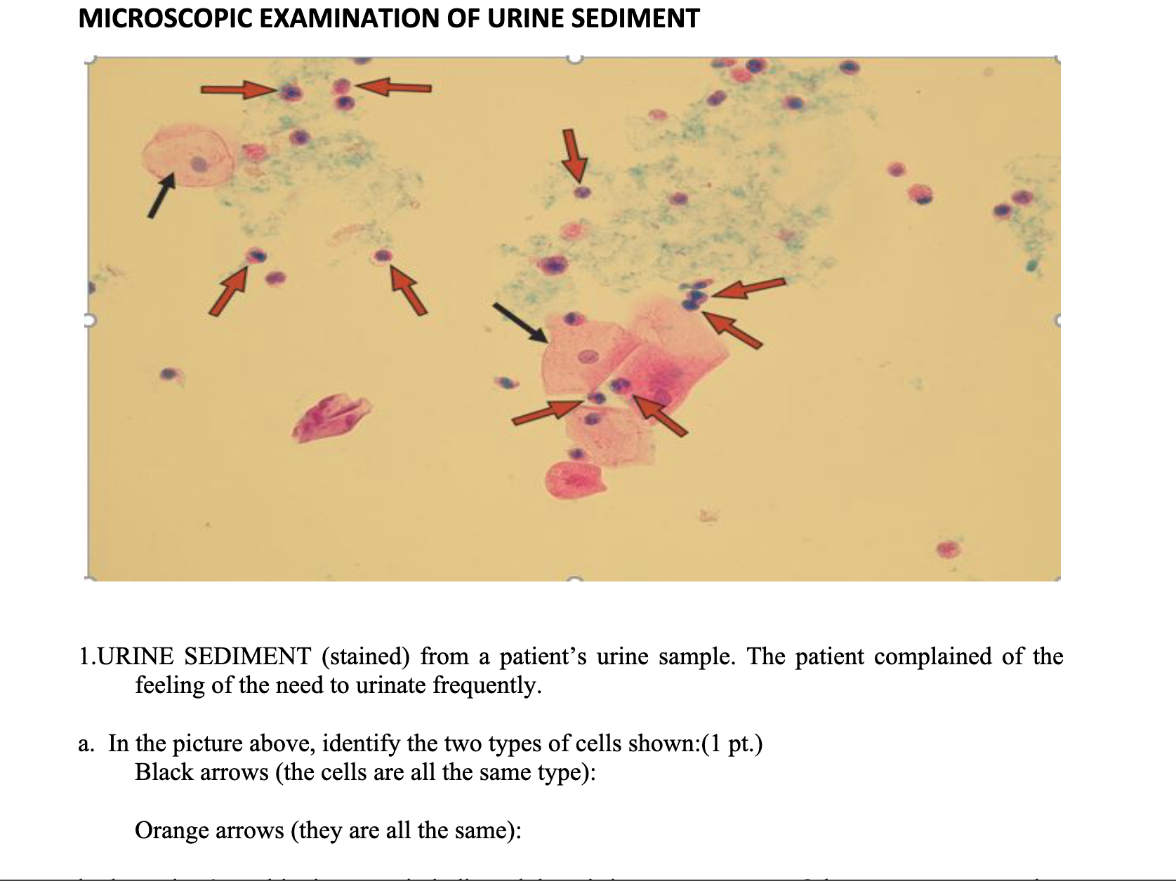 Solved 1.URINE SEDIMENT (stained) ﻿from a patient's urine | Chegg.com