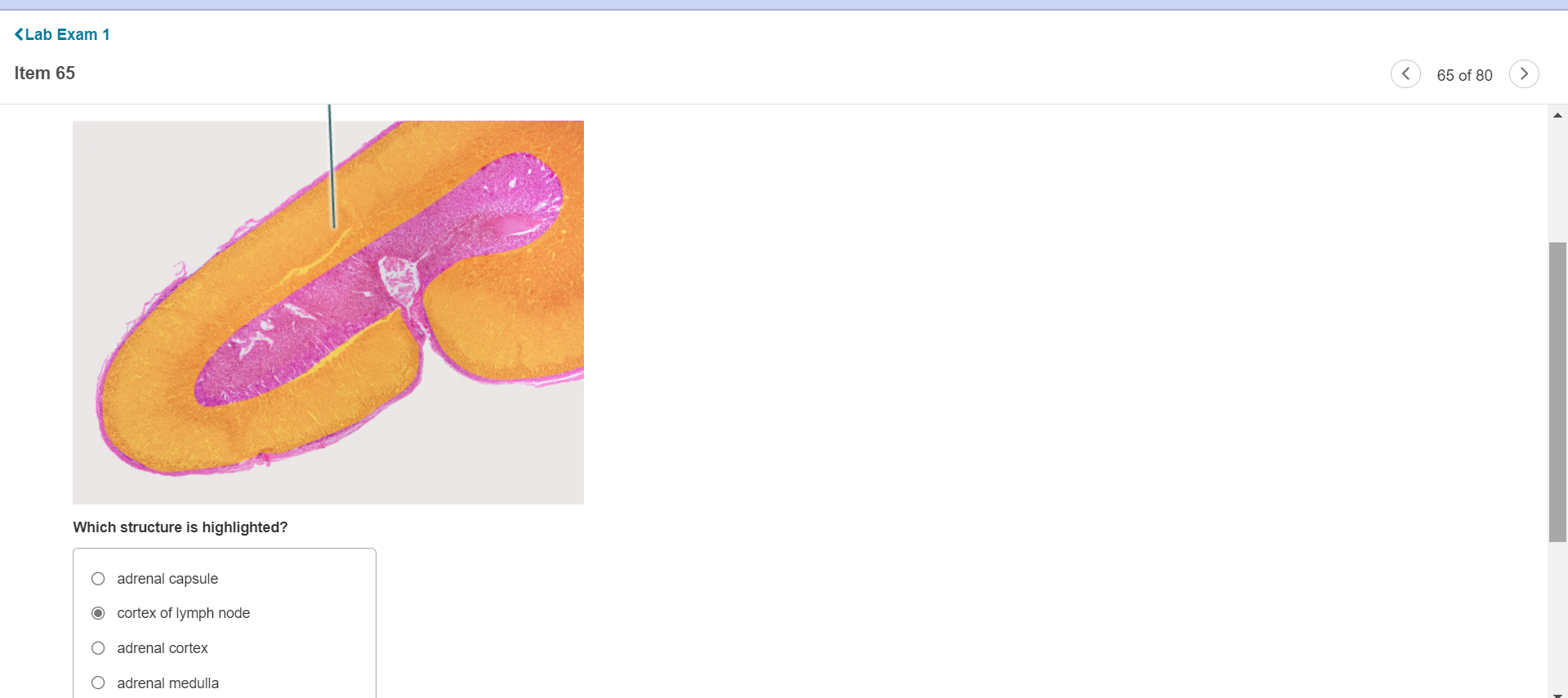 Solved Which structure is highlighted? adrenal capsule | Chegg.com