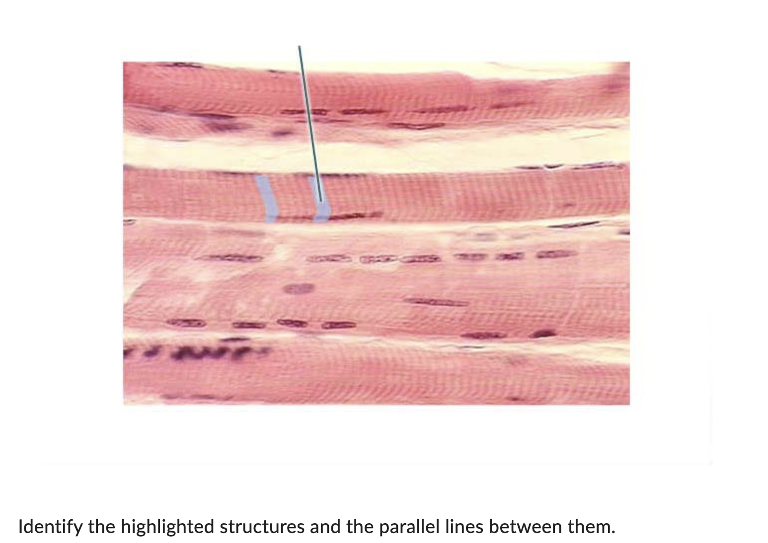 Solved Identify the highlighted structures and the parallel | Chegg.com