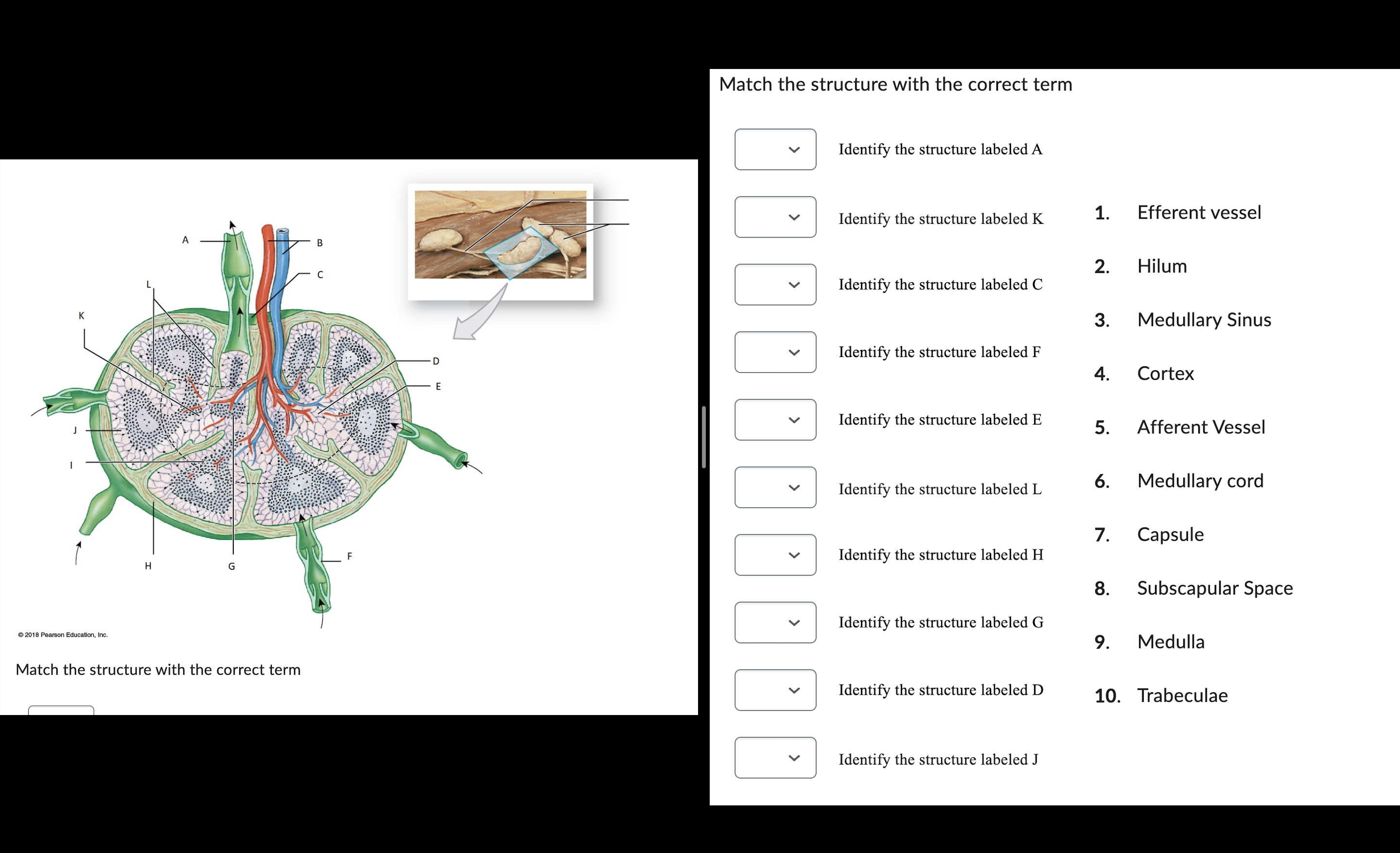 Solved Match the structure with the correct term Match the | Chegg.com
