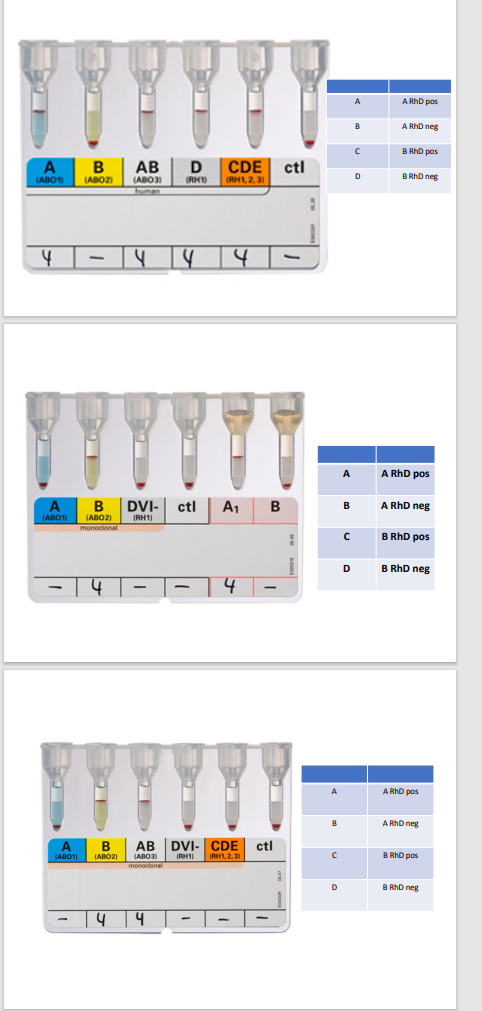 A RhD pos A RhD neg с B RhD pos А B (ABO2) AB (AB031 | Chegg.com