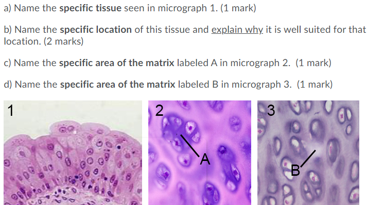 Solved a) Name the specific tissue seen in micrograph 1. (1 | Chegg.com