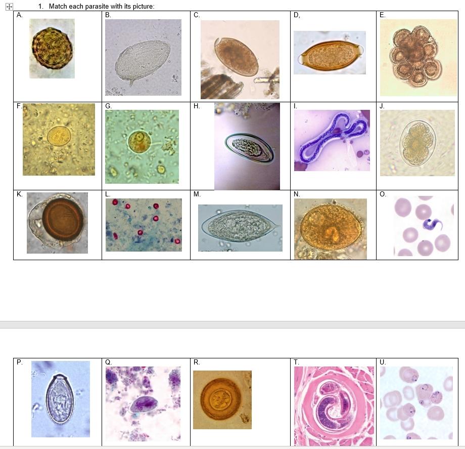 Solved 1. Match each parasite with its picture: B. A. C D, | Chegg.com
