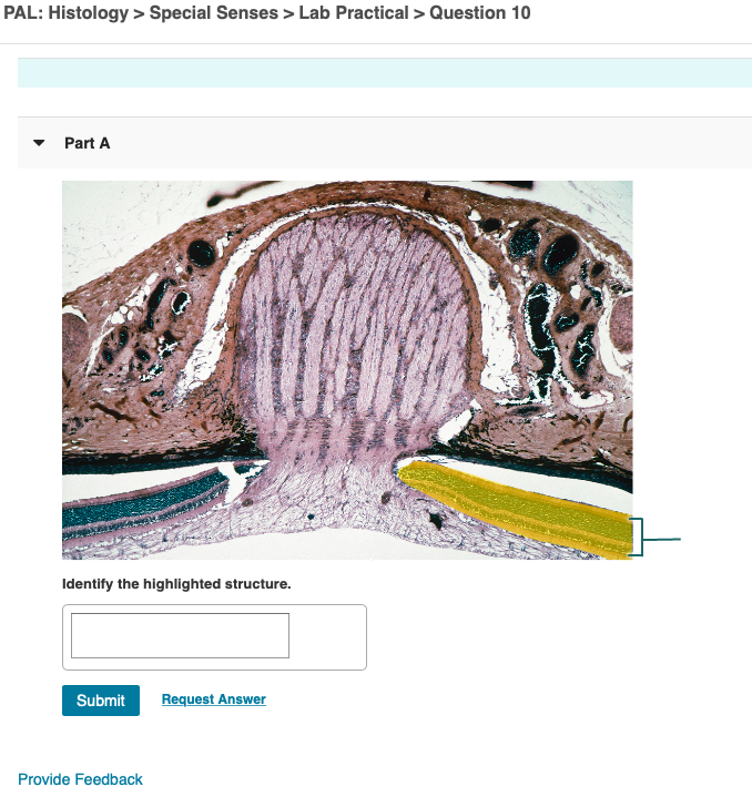 Solved PAL: Histology > Special Senses > Lab Practical | Chegg.com Solved PAL: Histology > Special Senses > Lab Practical | Chegg.com