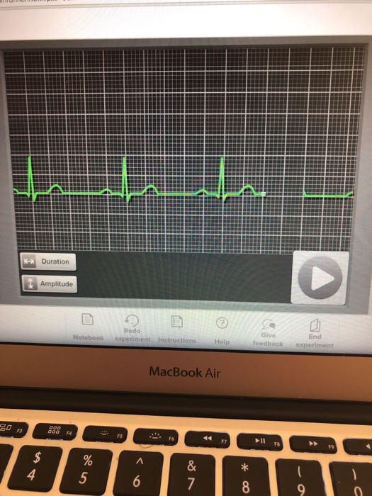 Solved "ECG Instructions Follow these steps to analyze an | Chegg.com