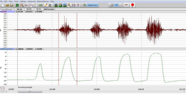 Solved Exercise 1: EMG Intensity and Force in Dominant | Chegg.com
