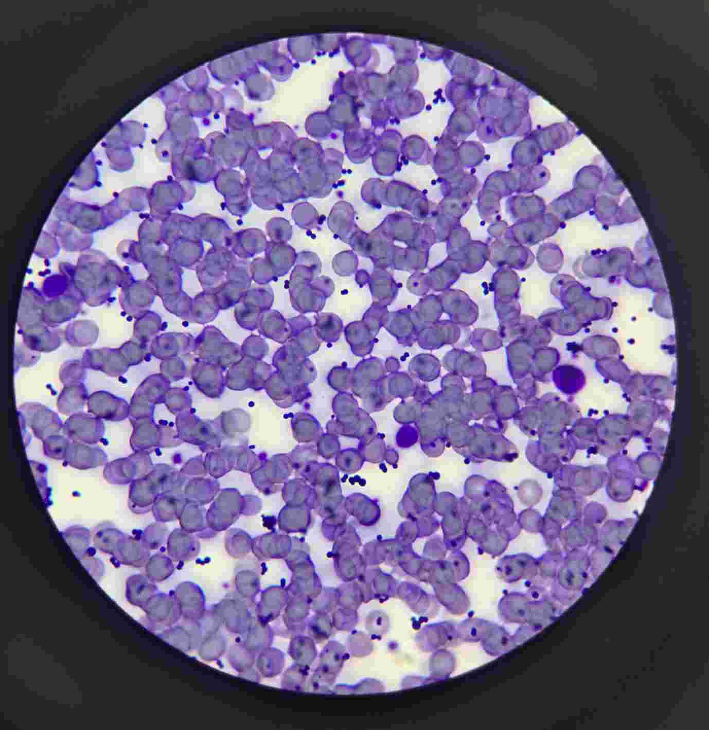 Solved after sudan black staining anf giemsa staining of a | Chegg.com