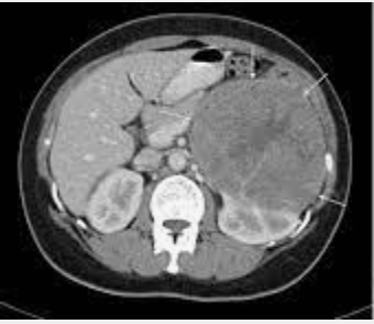 Solved Select all correct statements for the image below | Chegg.com