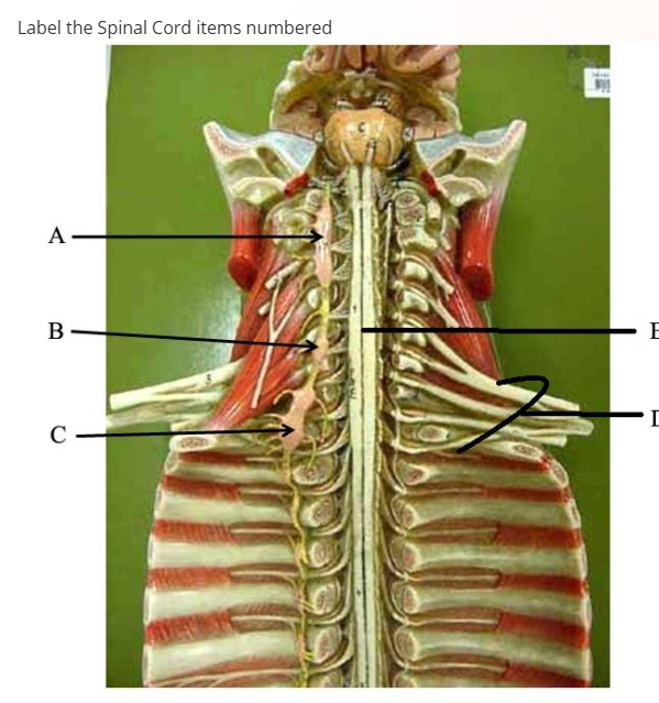Solved Label the Spinal Cord letters to the wordbank - | Chegg.com