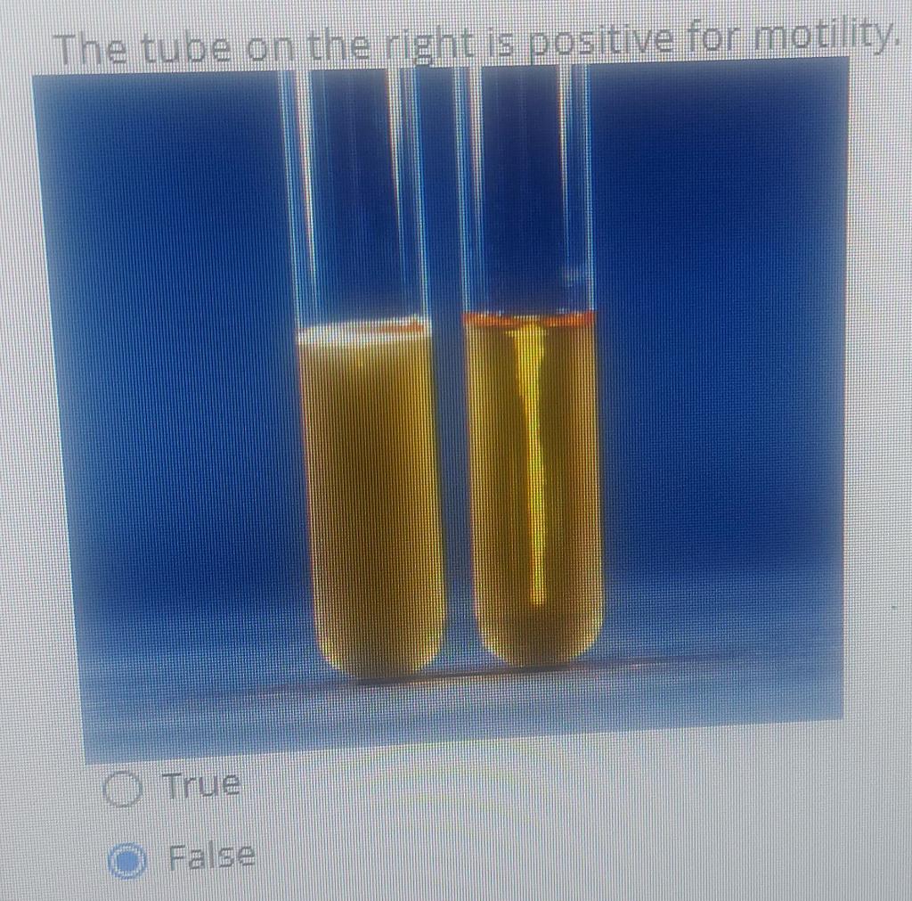 Solved The tube on the right is positive for motility. o | Chegg.com