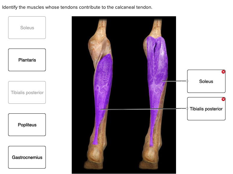 Solved Identify the muscles whose tendons contribute to the | Chegg.com