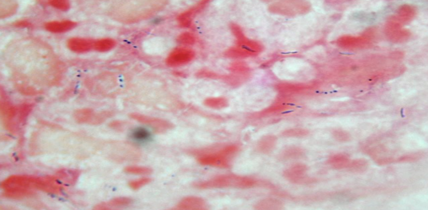 Solved The next image is _________________staining. What | Chegg.com