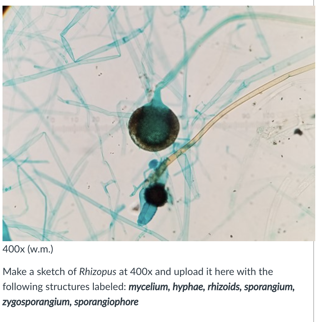 Solved 400x (w.m.) Make a sketch of Rhizopus at 400x and | Chegg.com