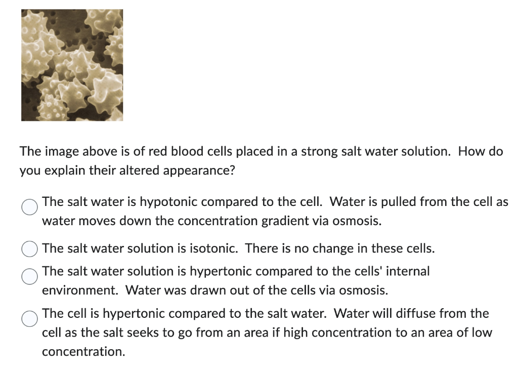Solved The image above is of red blood cells placed in a | Chegg.com